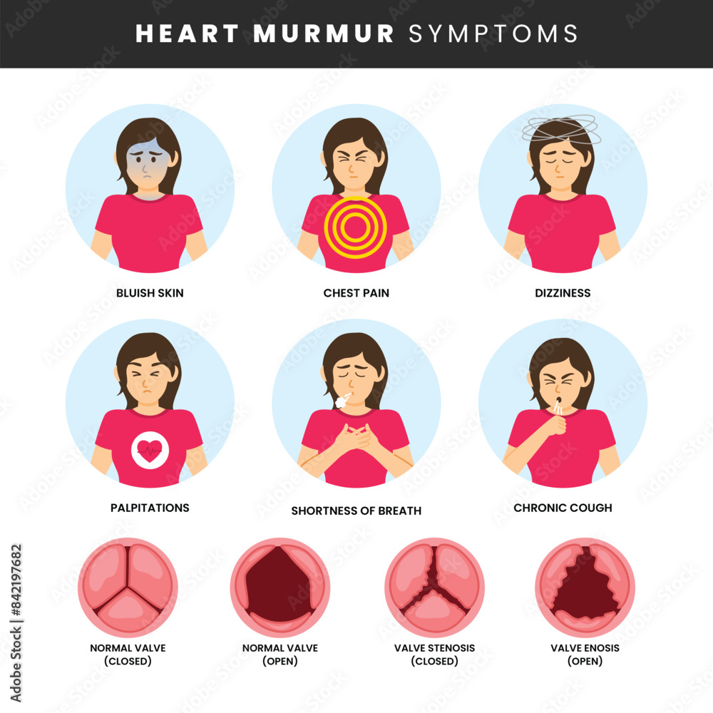 Heart murmur symptoms infographic medical poster design, labeled ...