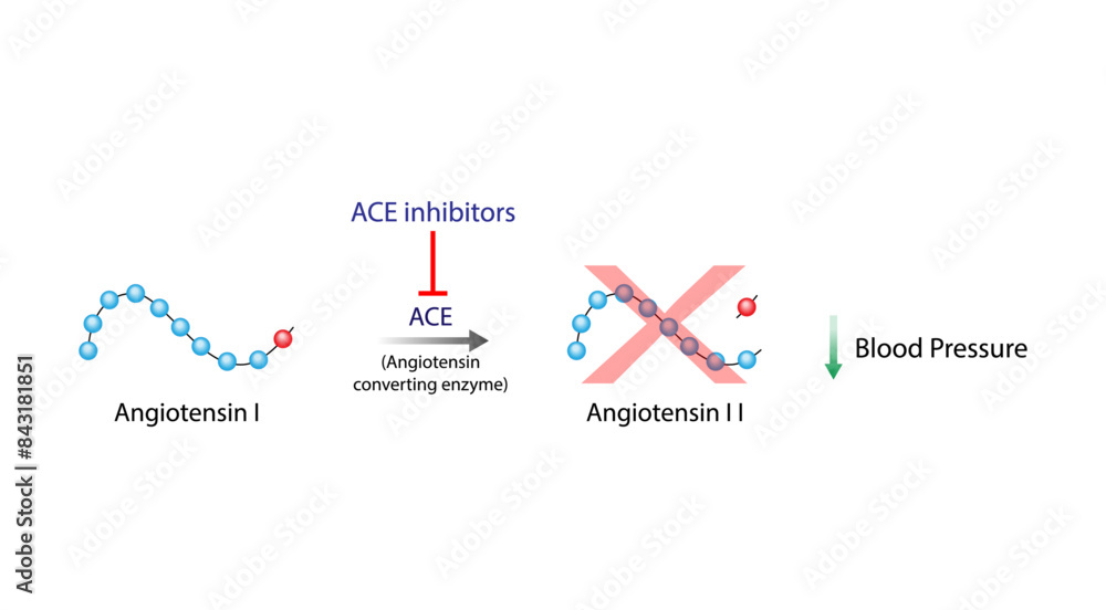 Angiotensin-converting enzyme inhibitors, ACE inhibitors. Renin ...