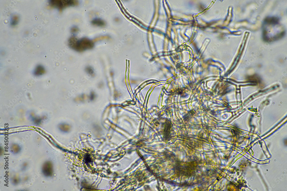 compost microorganisms under a microscope including amoeba, flagellates ...