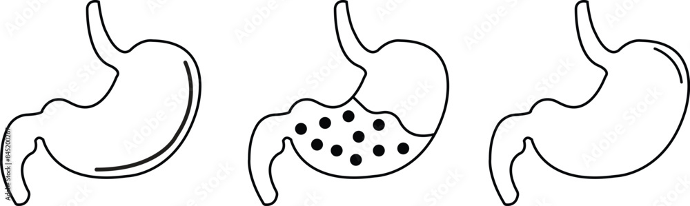 Set of Digestive system anatomy. Black colors Stomach gastric icons ...