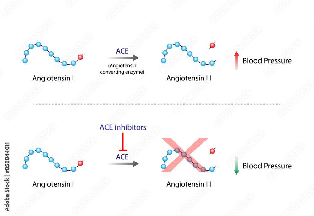 Angiotensin-converting enzyme inhibitors, ACE inhibitors. Angiotensin. Renin-Angiotensin ...