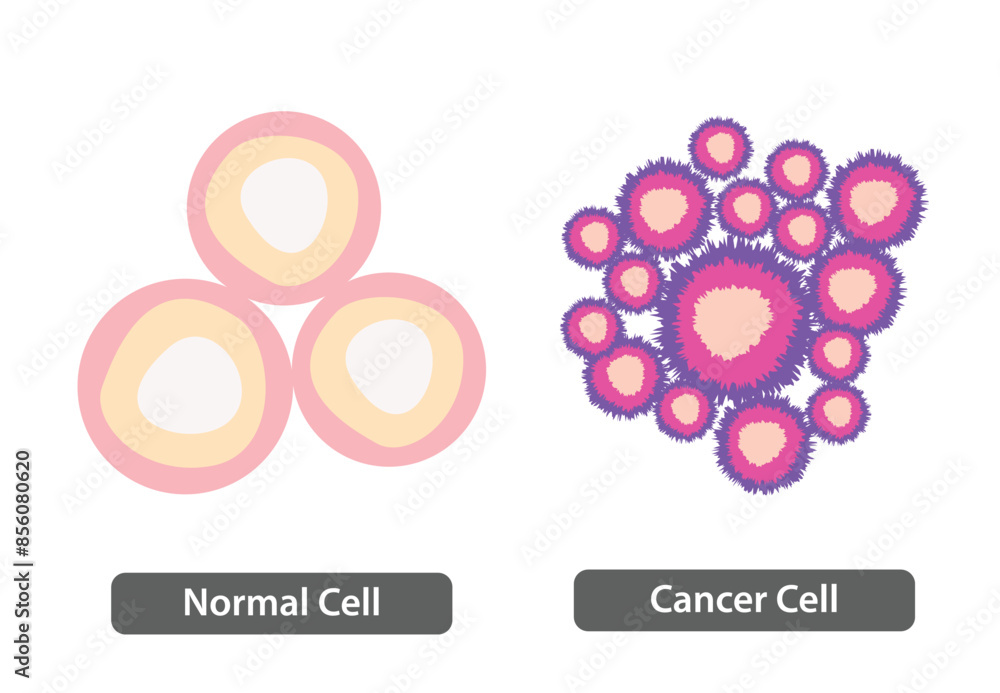 Normal Cell vs Cancer Cell, Loss of normal growth control of cell ...