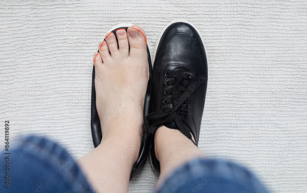 Foot deforming shoes. Incorrect anatomical shoes with flat soles. Small ...