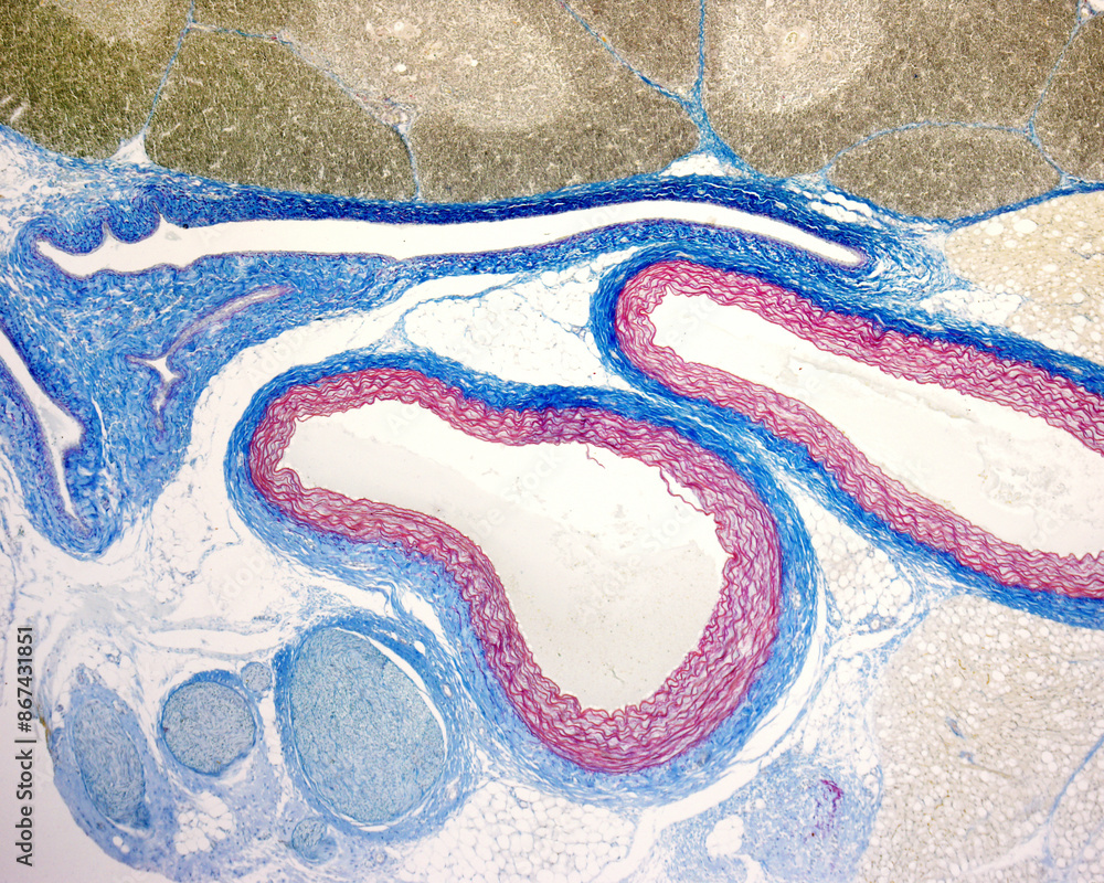 Elastic artery Stock Photo | Adobe Stock