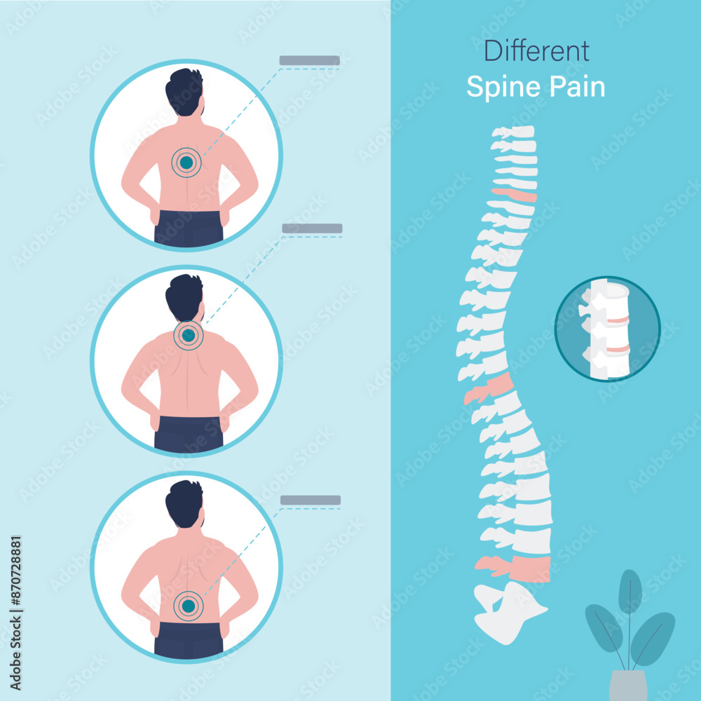 Back pain and body posture infographics with anatomical illustrations ...