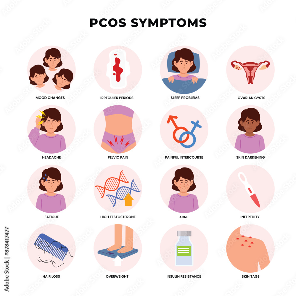 PCOS symptoms infographic medical poster education, labeled polycystic ...