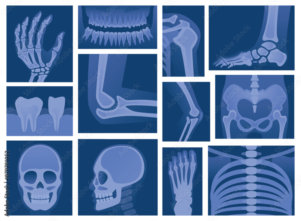 Body parts scanning. X ray skeleton human body medical scan of bones ...