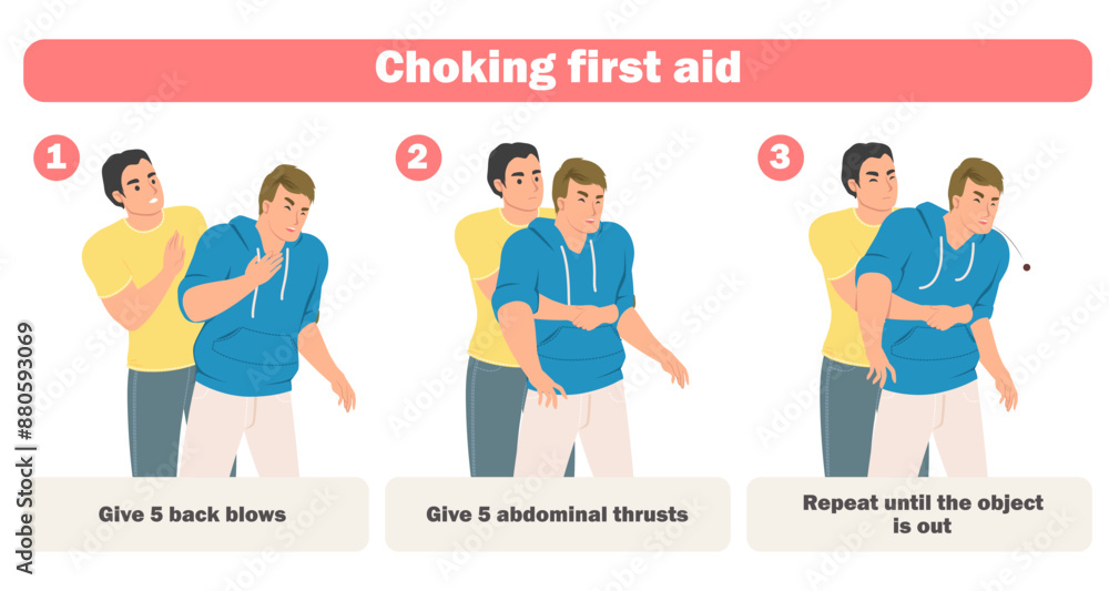 Choking first aid infographic poster with adults rescue emergency help. Stages of heimlich ...