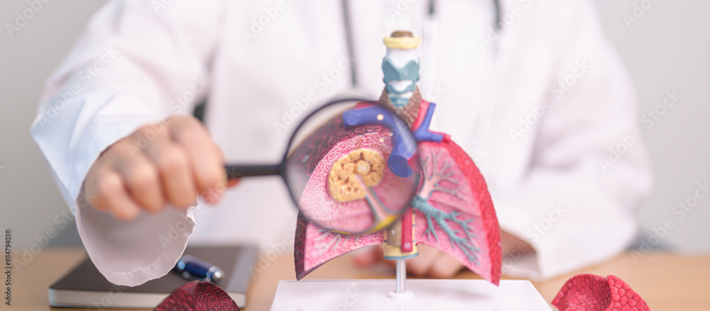 Doctor with Smoker Lung anatomy with magnifying glass. Lung Cancer ...