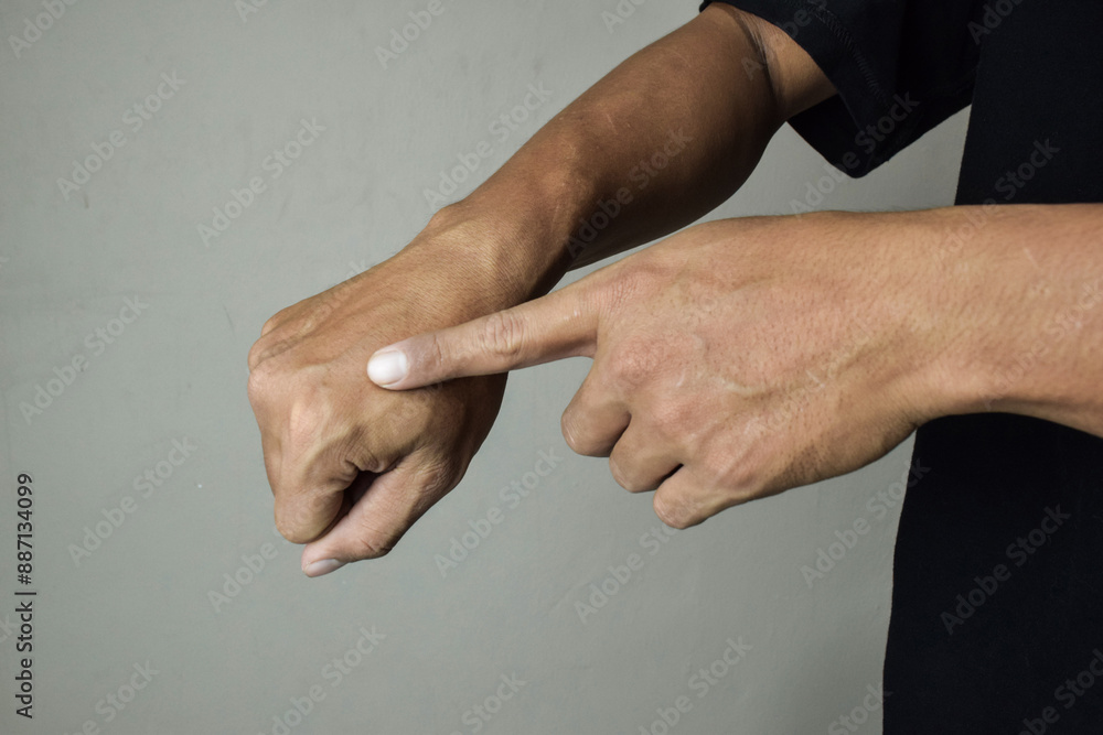 ภาพถ่าย Stock Men's hands pointing to rash skin, eczema and other skin ...