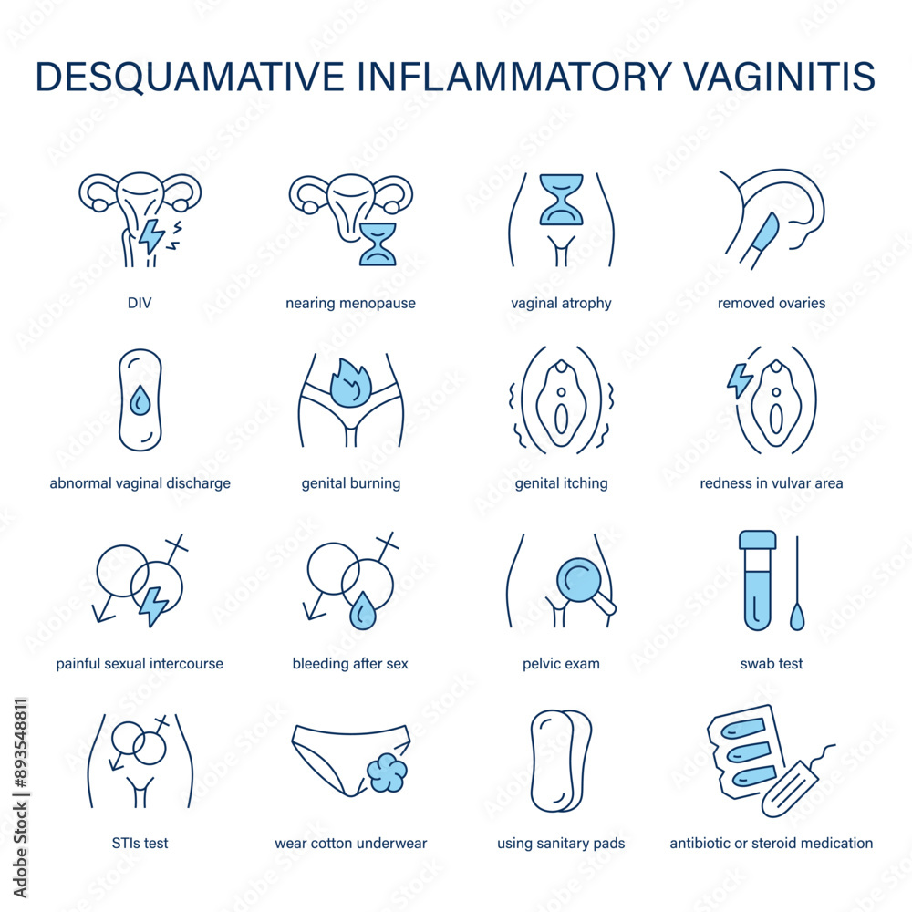 Desquamative Inflammatory Vaginitis symptoms, diagnostic and treatment ...