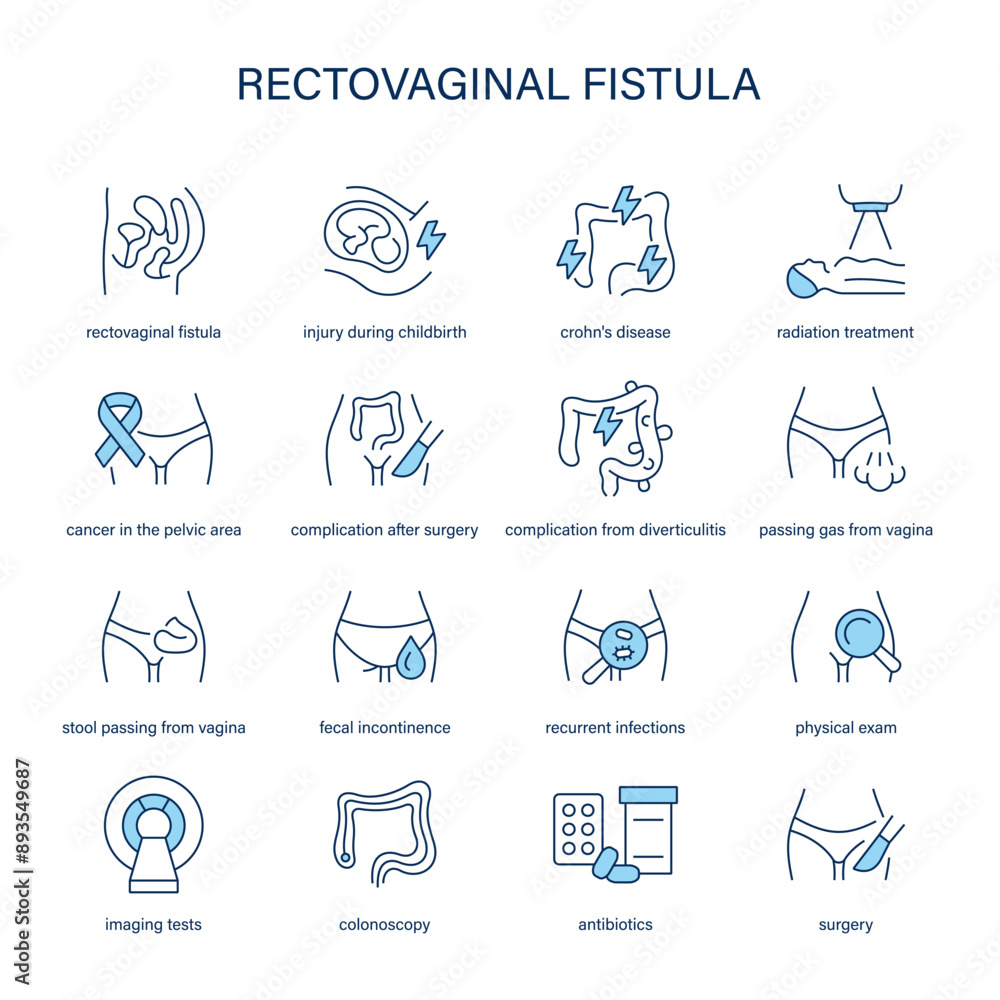Rectovaginal Fistula symptoms, diagnostic and treatment vector icons ...