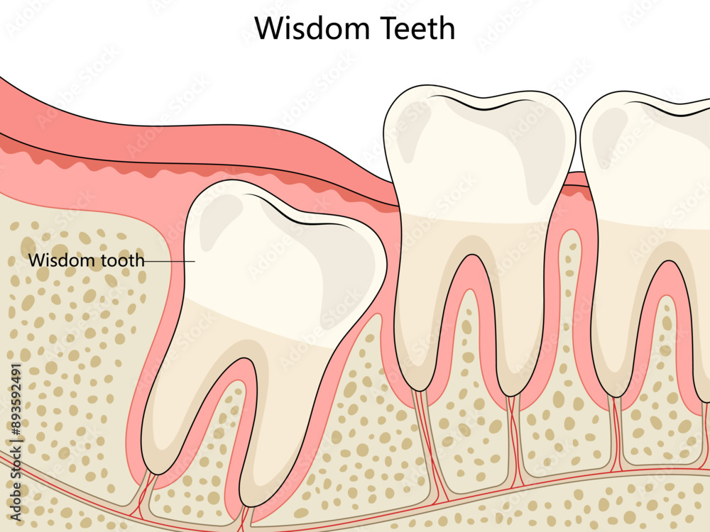 position and structure of wisdom teeth in the human jaw structure ...