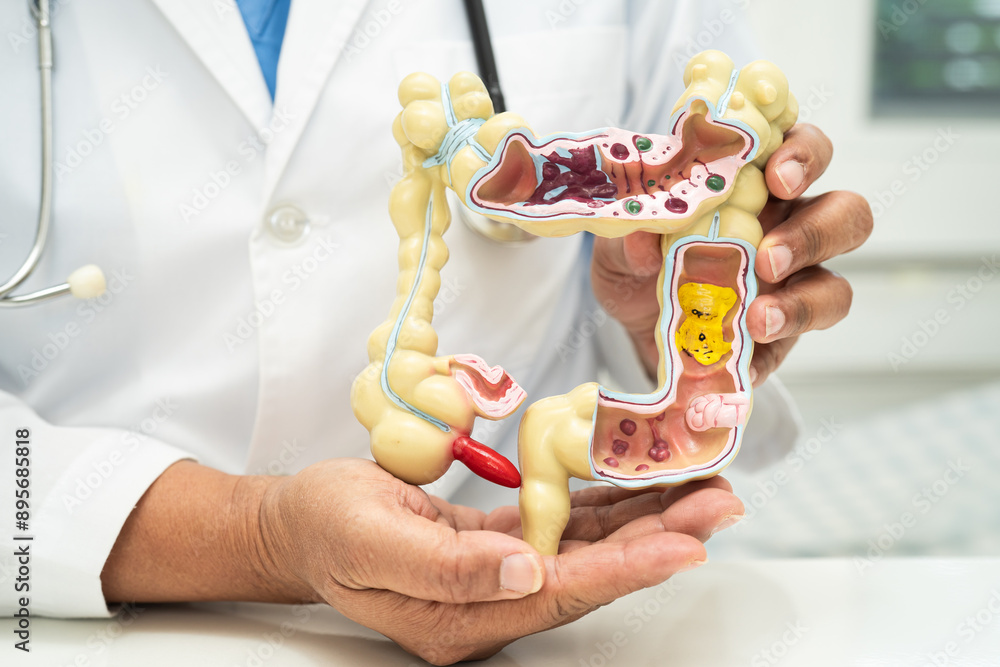 Intestine, appendix and digestive system, doctor holding anatomy model ...