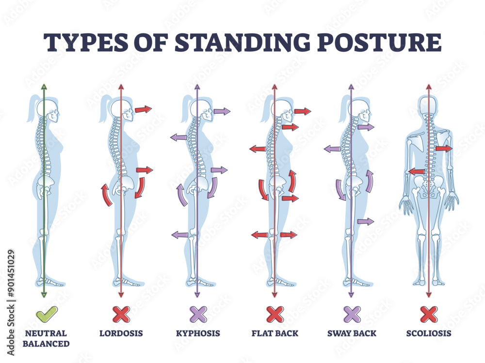 Types of standing postures and medical back pathology set outline ...