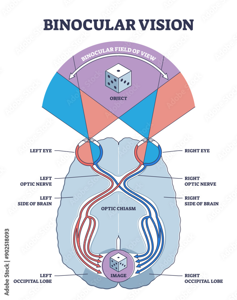 Binocular vision type explanation with anatomical nerve pathway outline ...