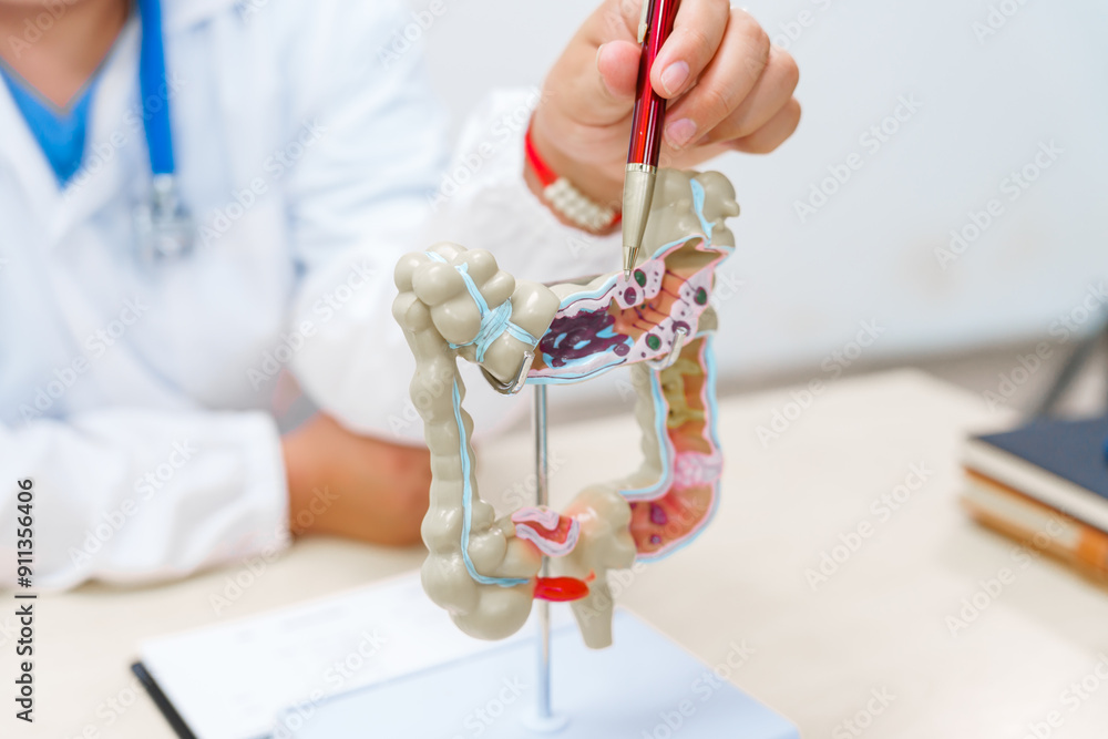A doctor holds a human colon anatomy model, demonstrating the digestive ...