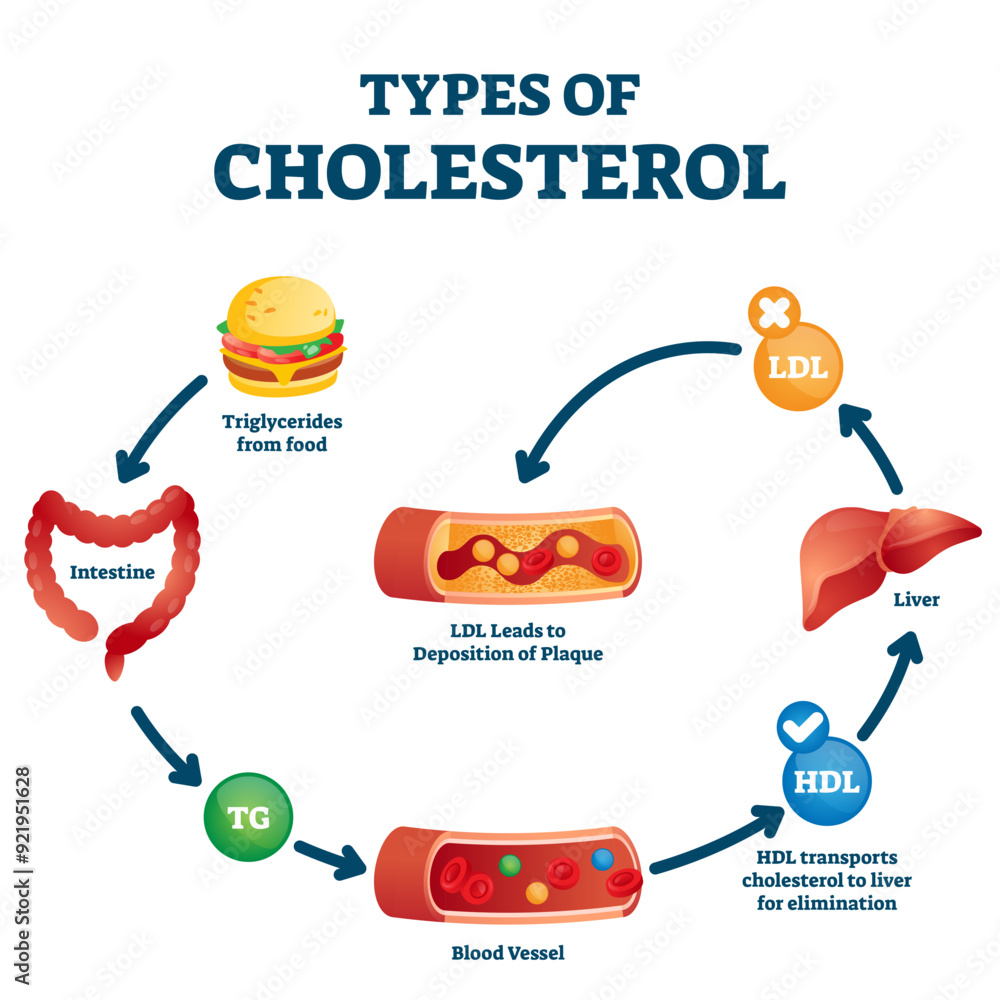 Types of cholesterol educational cycle scheme from fatty food to artery ...