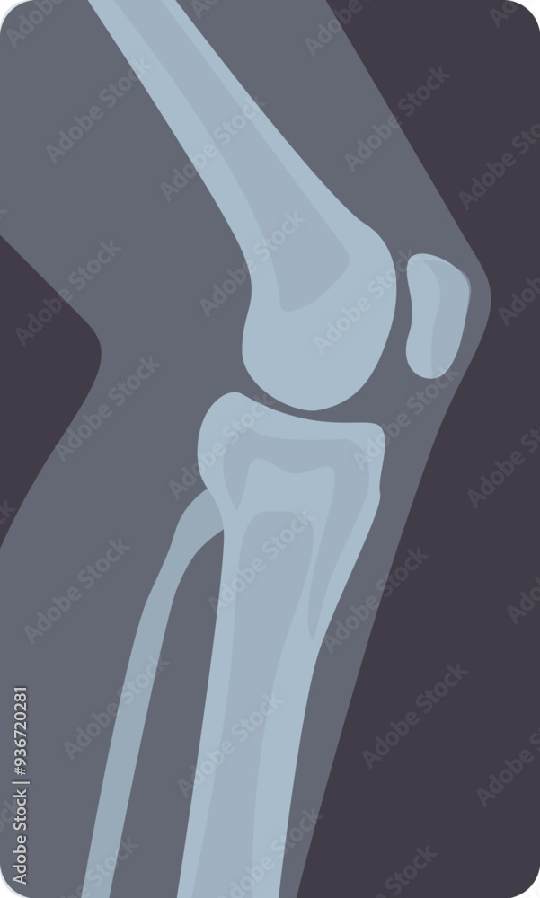 Lateral radiograph of human knee joint. Monochrome x-ray picture or ...