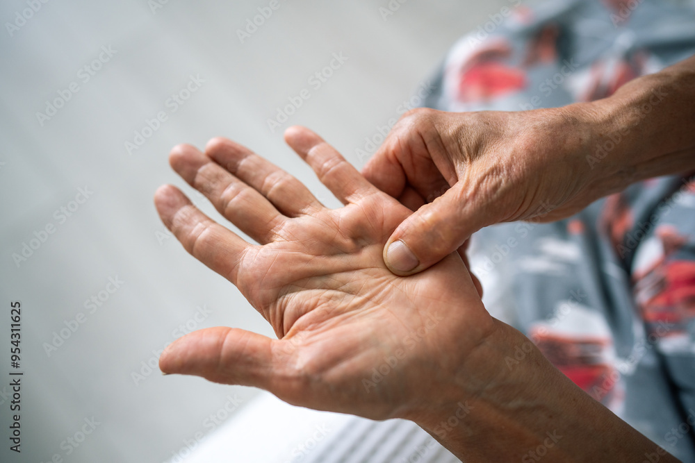 Dupuytren contracture and protuberance on palm. Elderly woman rubs ...