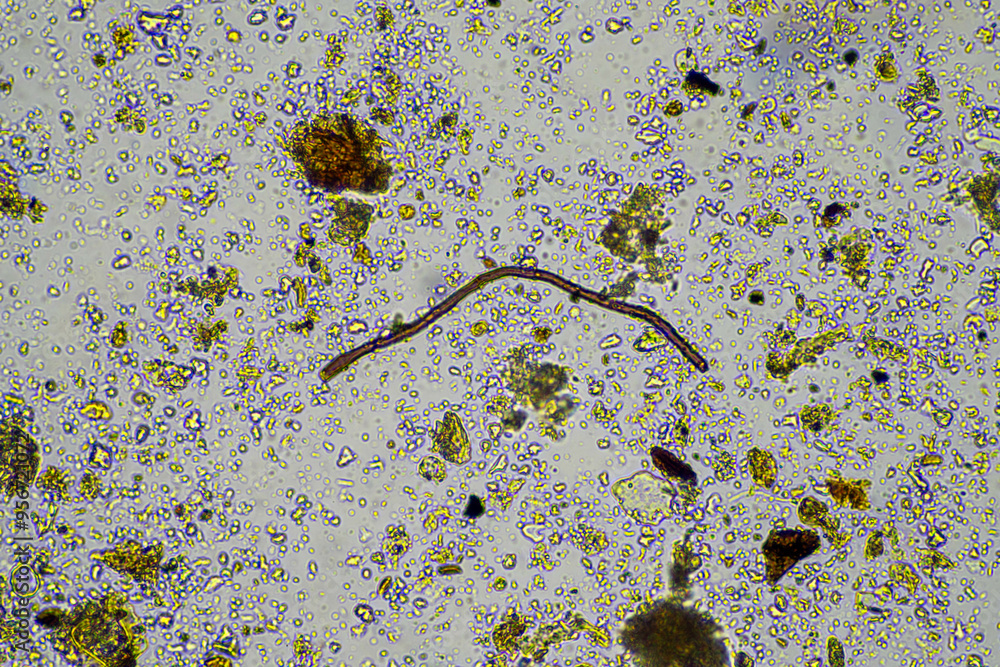 Foto de Stock Soil under the microscopy, looking at sand, silt and clay ...