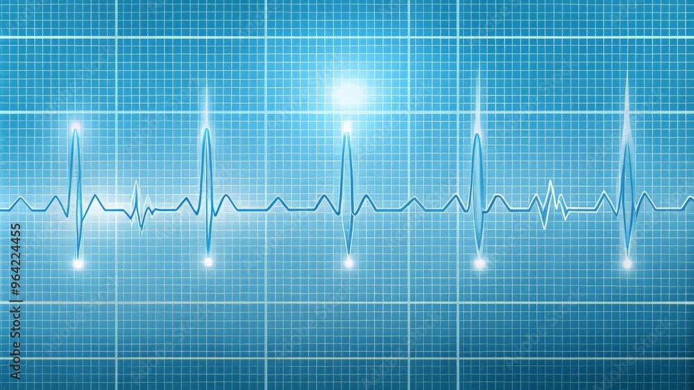Detailed vector graphic depicting a normal electrocardiogram waveform ...