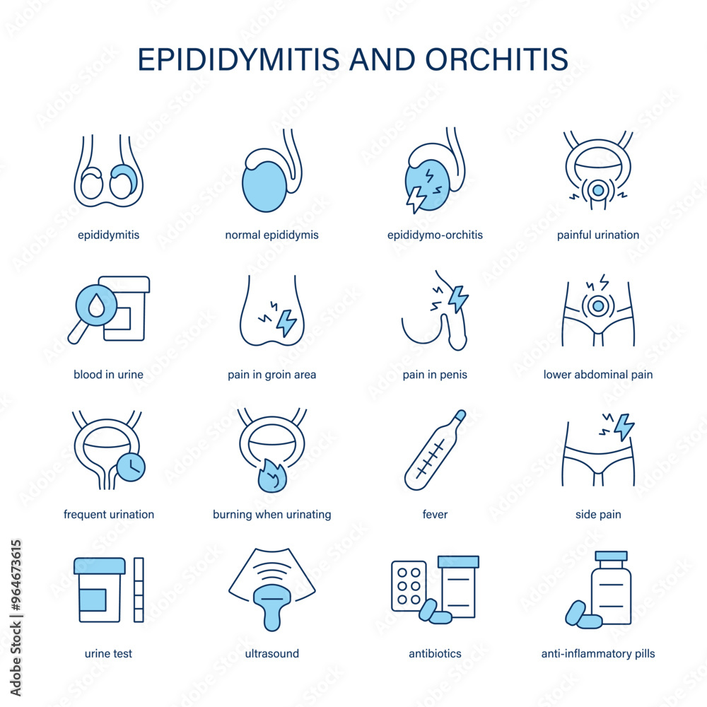 Stock-Vektorgrafik „Epididymitis and Orchitis symptoms, diagnostic and ...