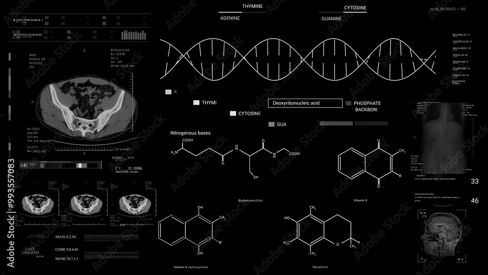 MRI x ray Scan, DNA chemistry structure formula. Medical monitor. HUD ...