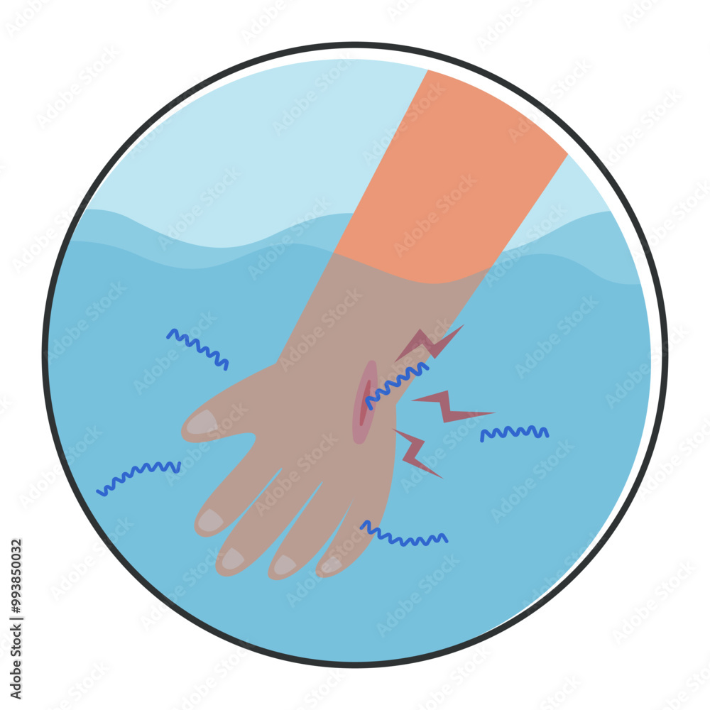 leptospirosis infection disease from leptospira bacteria in rat urine ...