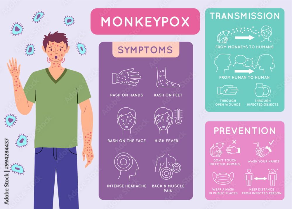 Cartoon Color Monkeypox Virus Infographic Poster Card Medicine Concept ...