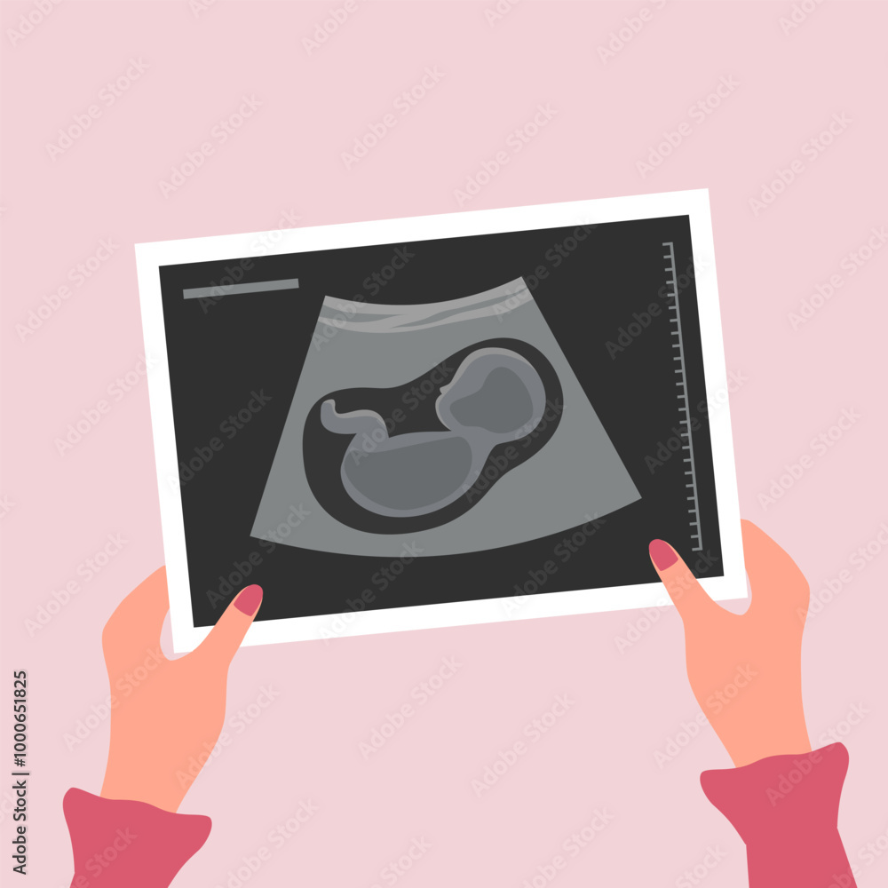 Female hands holding a photo of a baby on ultrasound scan in the womb ...