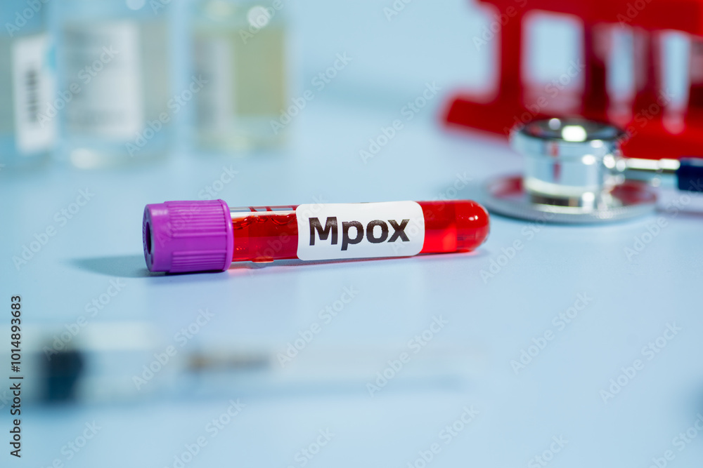 Blood collection tubes Mpox test positive results,WHO to rename ...
