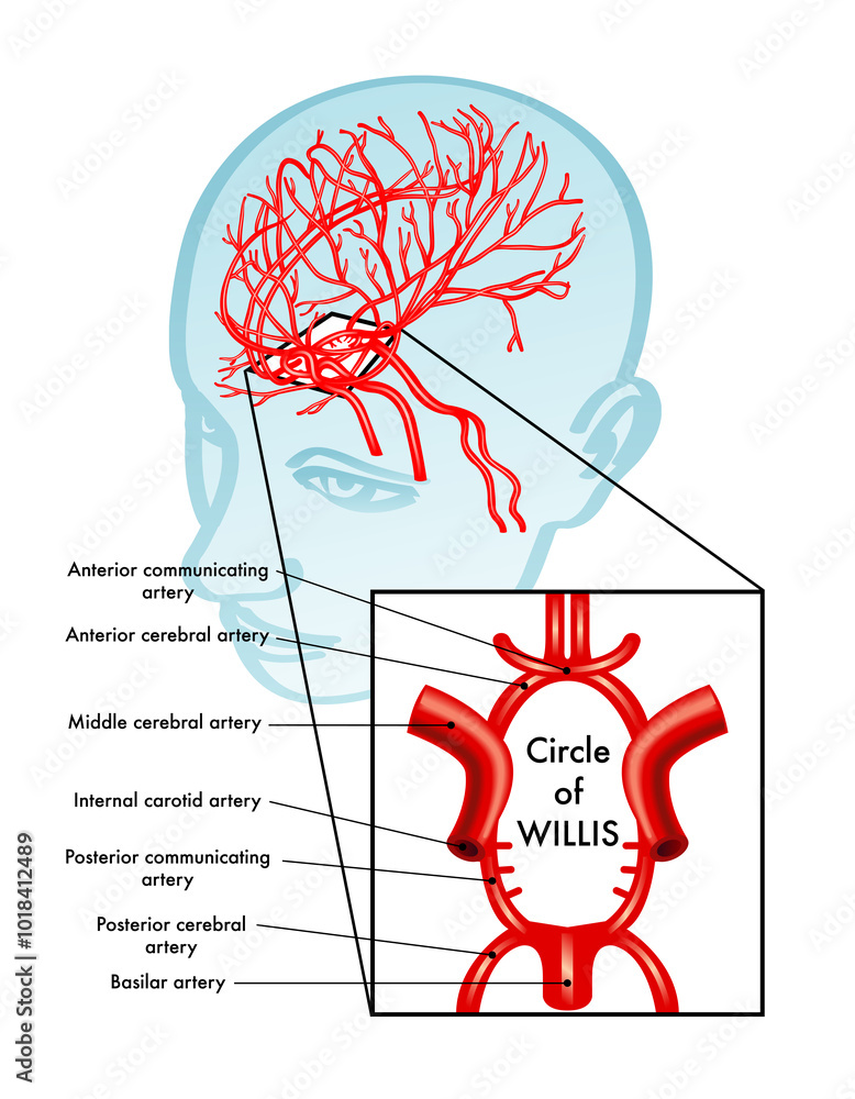 Medical illustration showing the location of the Circle of Willis in ...