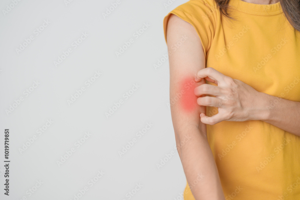 woman itching and scratching itchy arm. Sensitive Skin Allergic ...