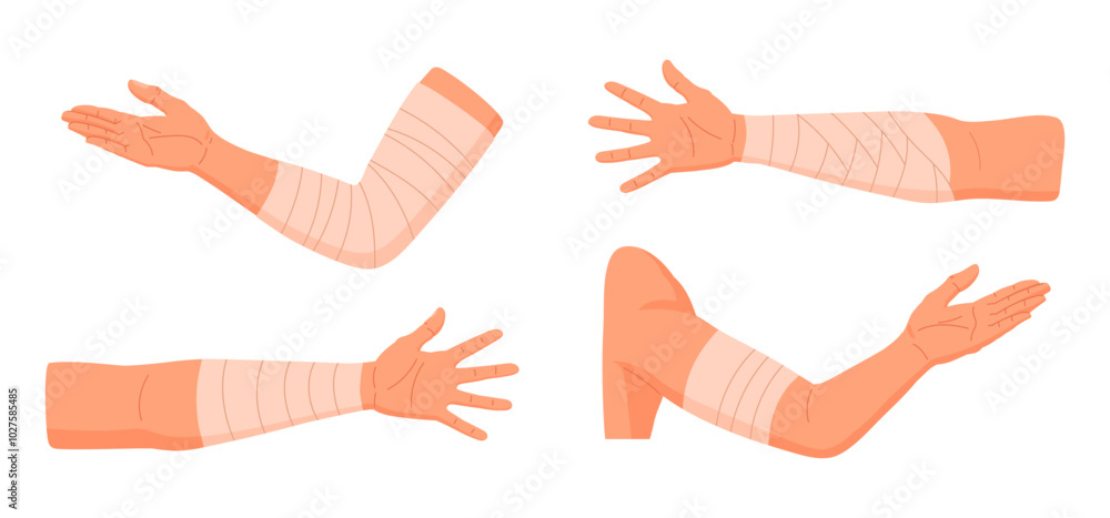 Injured human arms. Bandaged elbows and forearms, damaged arm parts ...