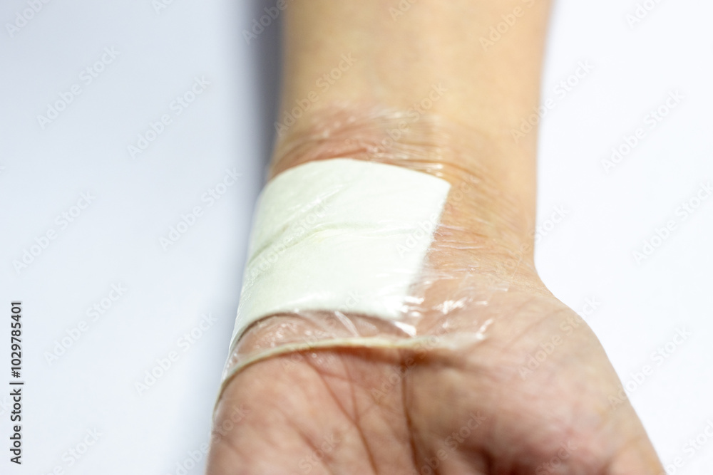 Wound and Scar on different parts of the body, Caused by an accident ...