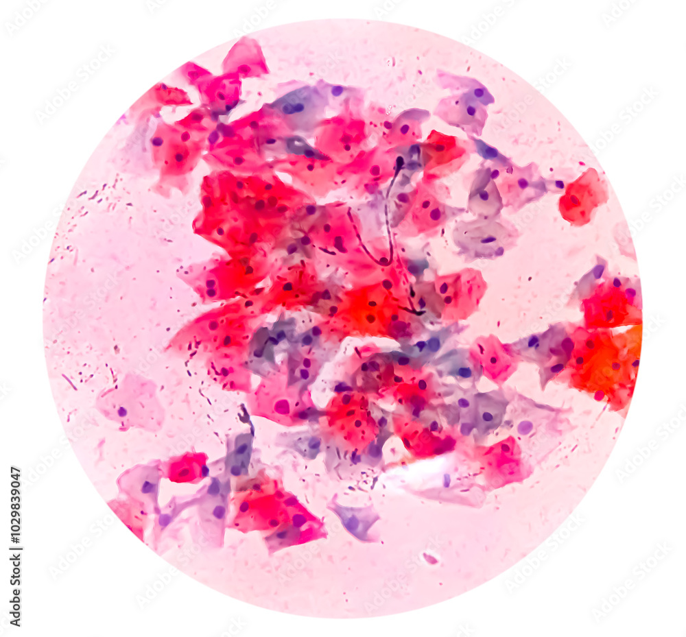 Стоковое фото «Buccal smear showing desquamated squamous cells of the ...
