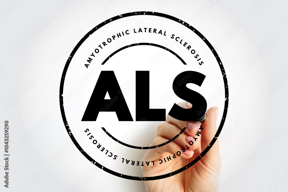 ALS Amyotrophic Lateral Sclerosis - progressive nervous system disease ...