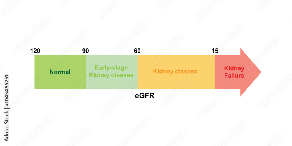 Chronic Kidney Disease Ckd Stages Scientific Design Vector