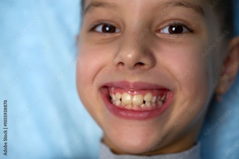 Cute girl with teeth retainers looking at camera, close-up. Child with ...
