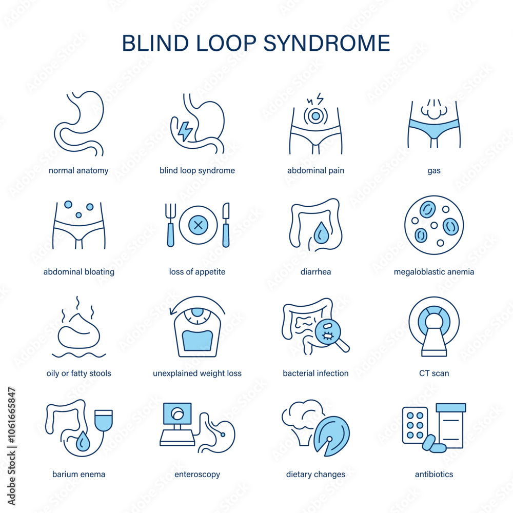 Vector de Stock Blind Loop Syndrome symptoms, diagnostic and treatment ...