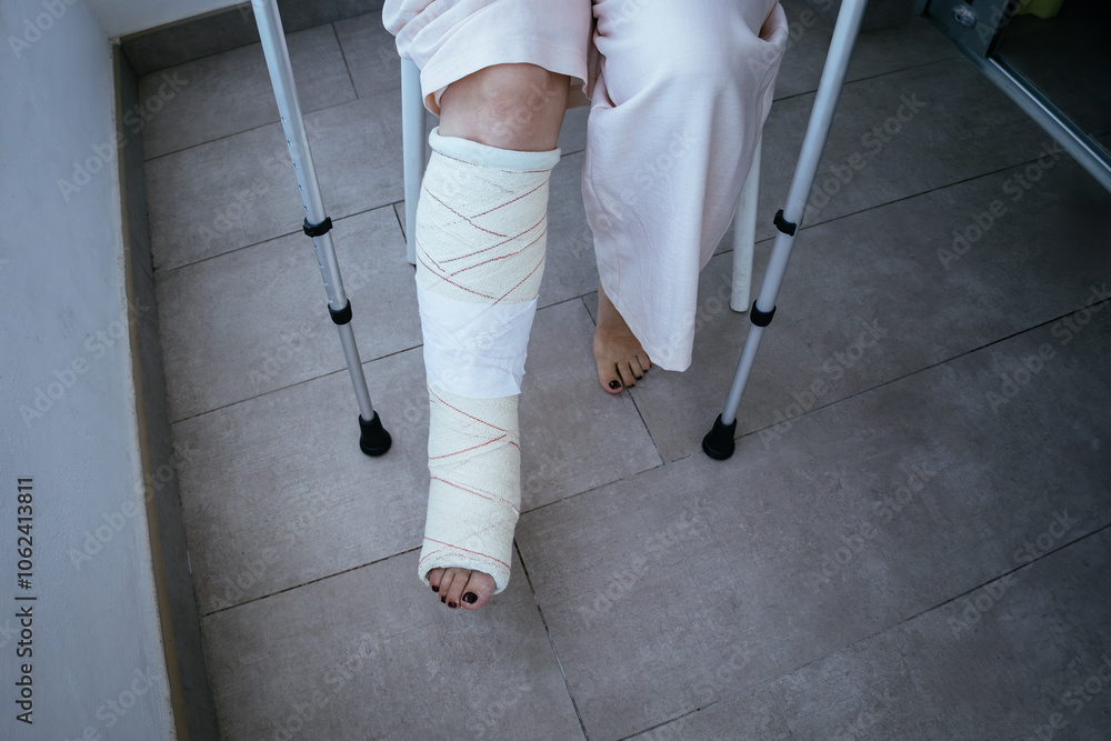 Woman with plastered leg, crutches in a balcony after serious physical ...