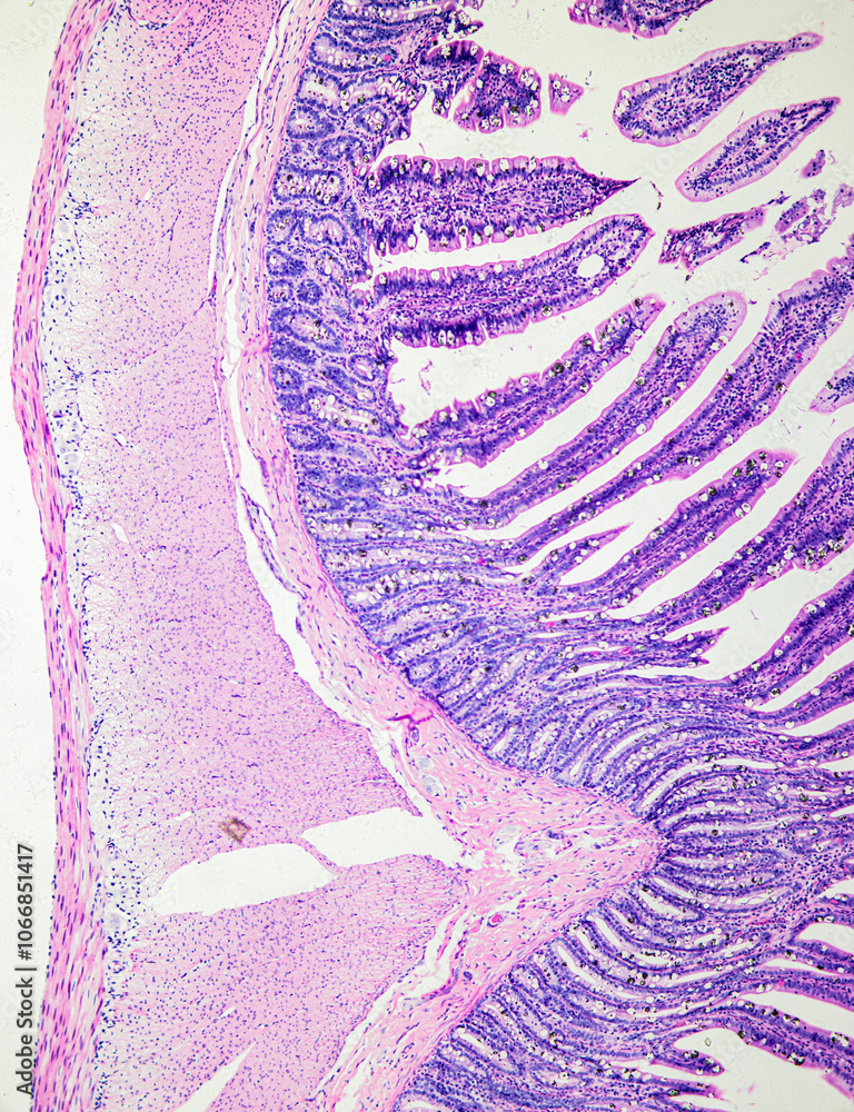 This is a histological photograph of the human small intestine ...