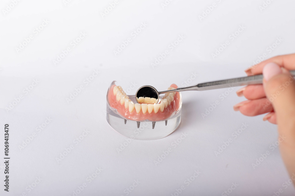 render of mandibular prosthesis all on 4 system supported by implants ...