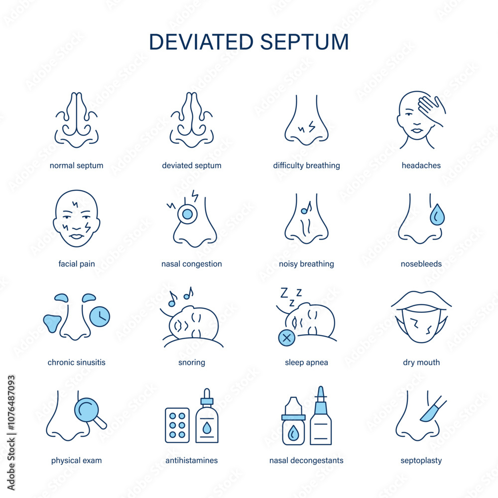Deviated Septum symptoms, diagnostic and treatment vector icon set ...