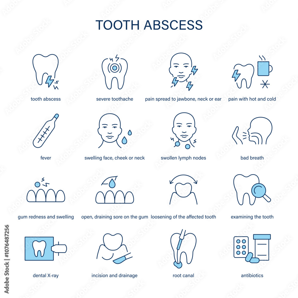 Vector de Stock Tooth Abscess symptoms, diagnostic and treatment vector ...