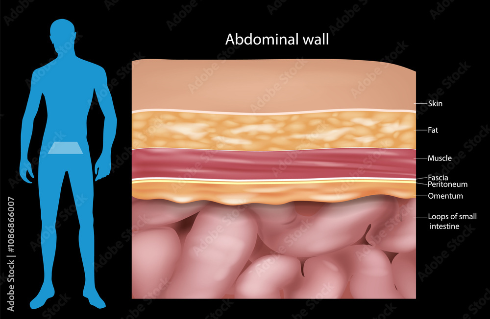 Abdominal wall Layers, muscles and fascia. Cross-section Anatomy ...