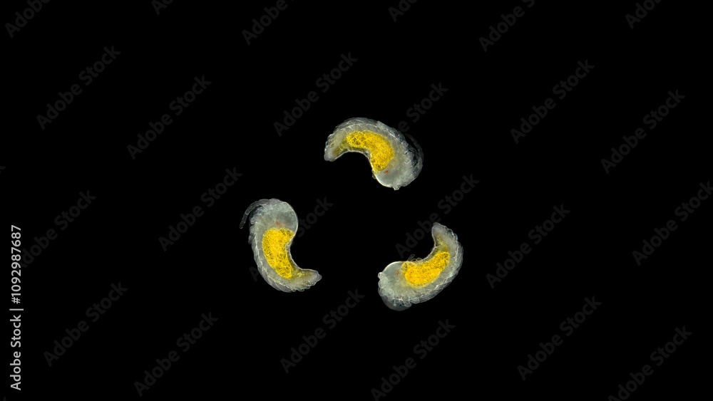 Isopoda embryo of the Asellidae family under a microscope. Formed limbs ...