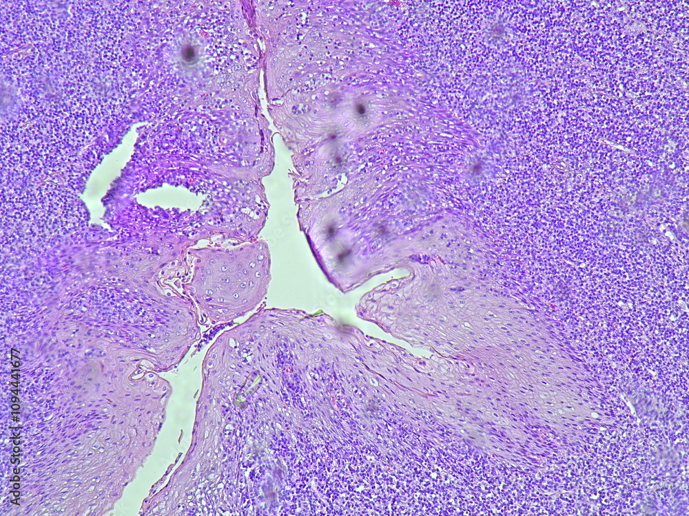 Anatomy and Histology of Bilateral Tonsils and Parotid Human Cells with ...