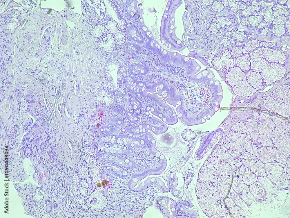 Стоковое фото «Human cell tissue under microscope in pathology ...